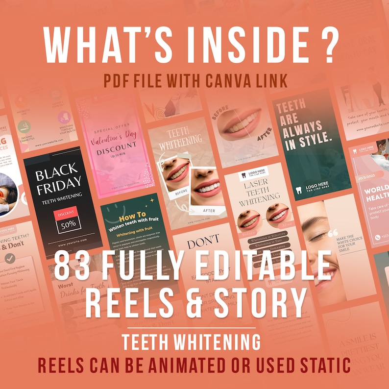 Teeth Whitening Instagram Reels Template, Dental Reels Template, Reels ...