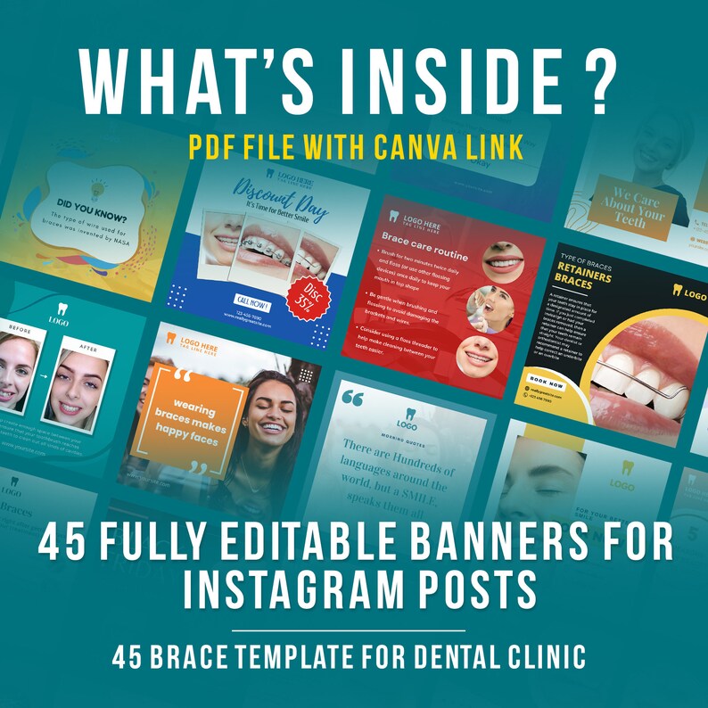 Dental Braces Templates, Instagram Post, Editable Template, Social ...
