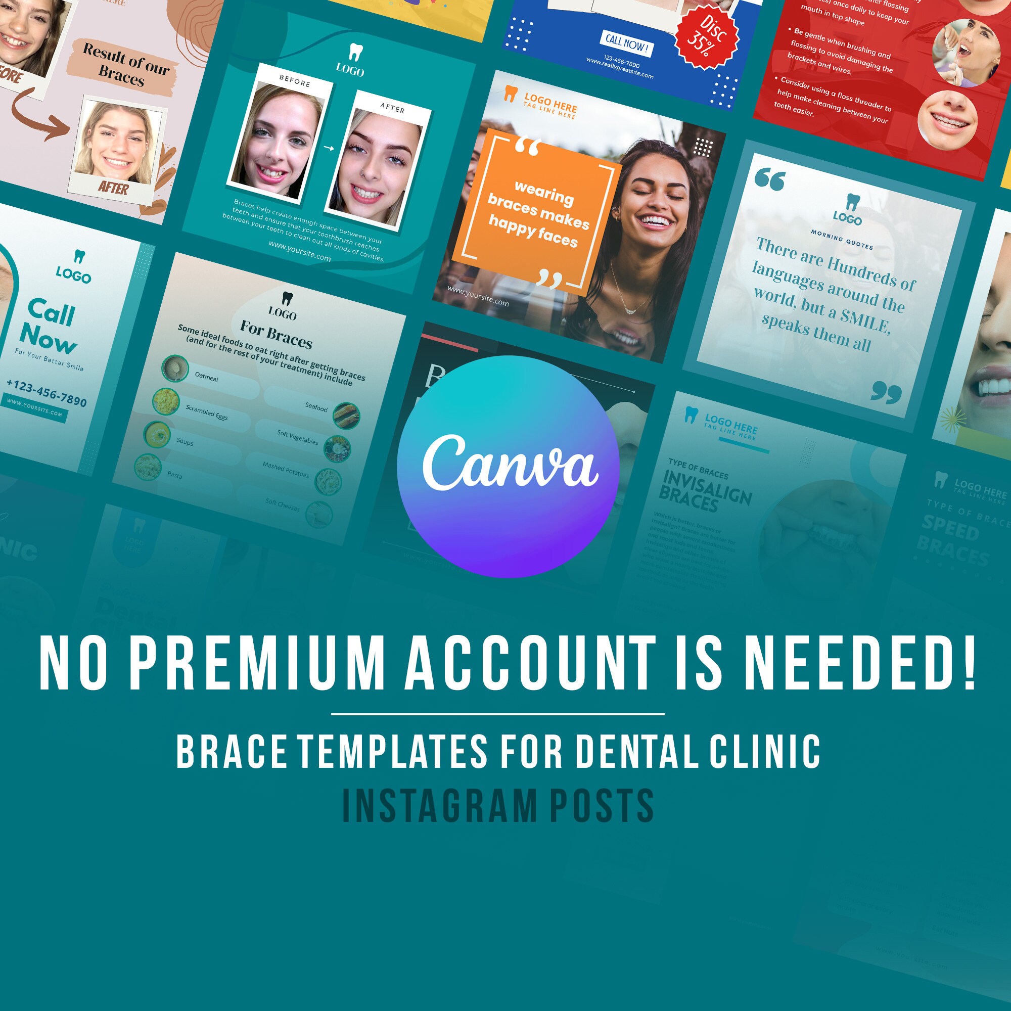 Dental Braces Templates, Instagram Post, Editable Template, Social ...