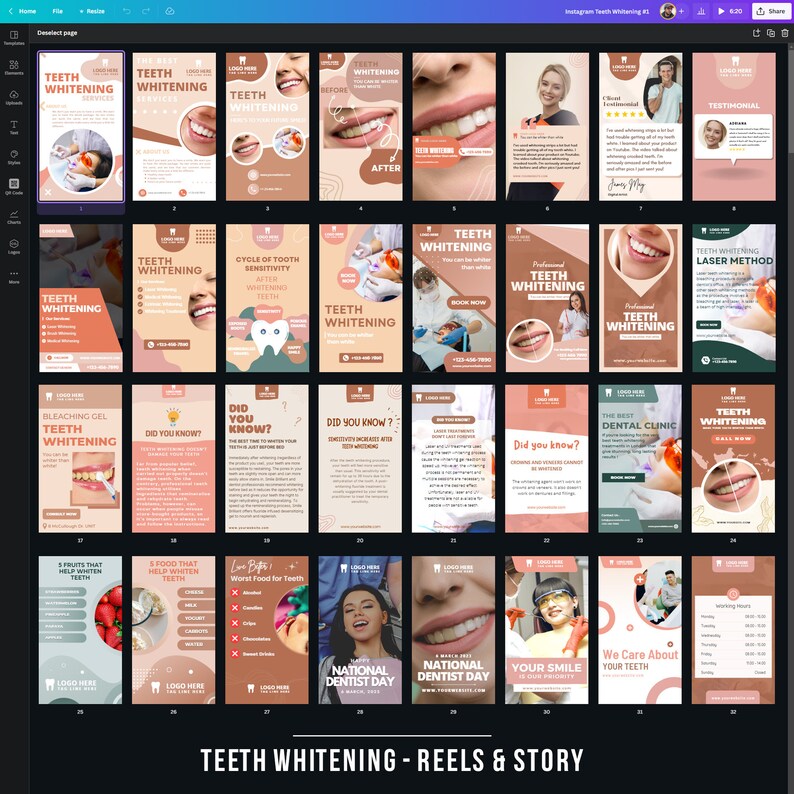 Teeth Whitening Instagram Reels Template, Dental Reels Template, Reels ...