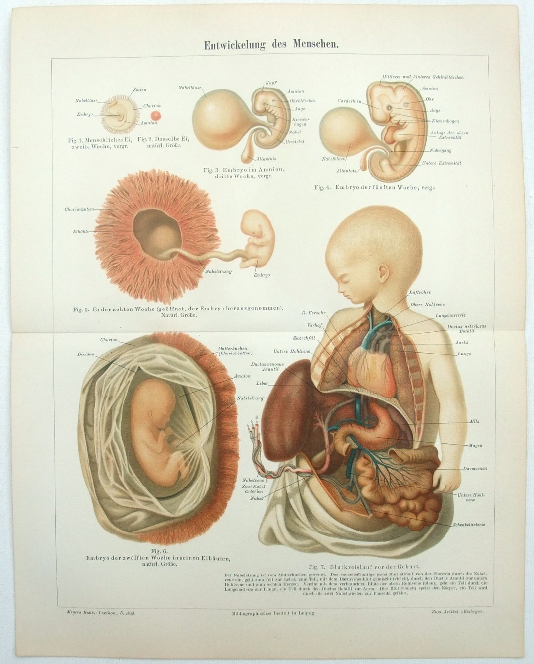 Human Development - Original 1894 Color Lithograph by Meyers. Embryo ...