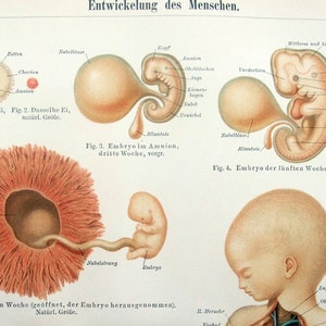 Human Development - Original 1894 Color Lithograph by Meyers. Embryo ...