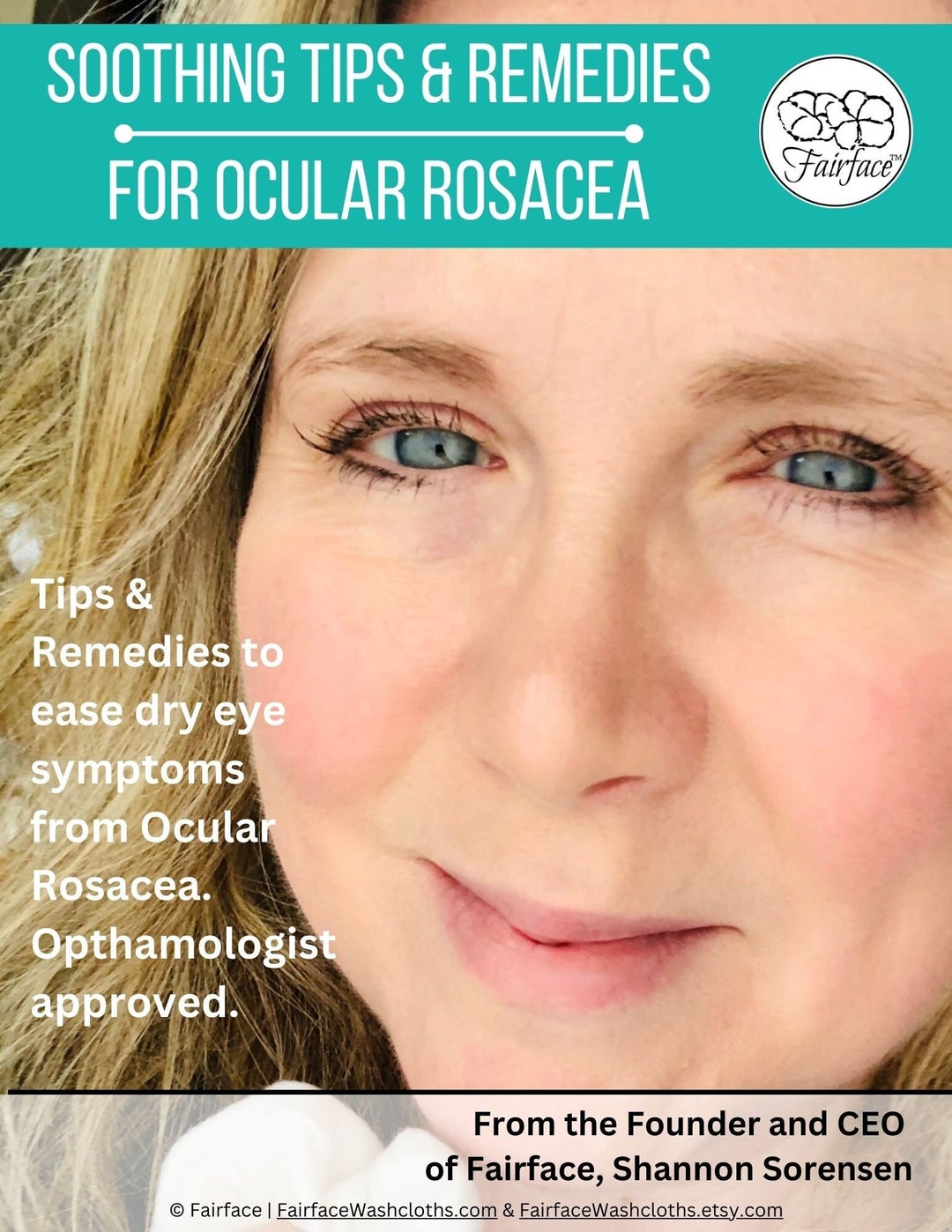 Ocular Rosacea Digital Guide, Dry Eyes Help, Ocular Rosacea Tips, Dry ...