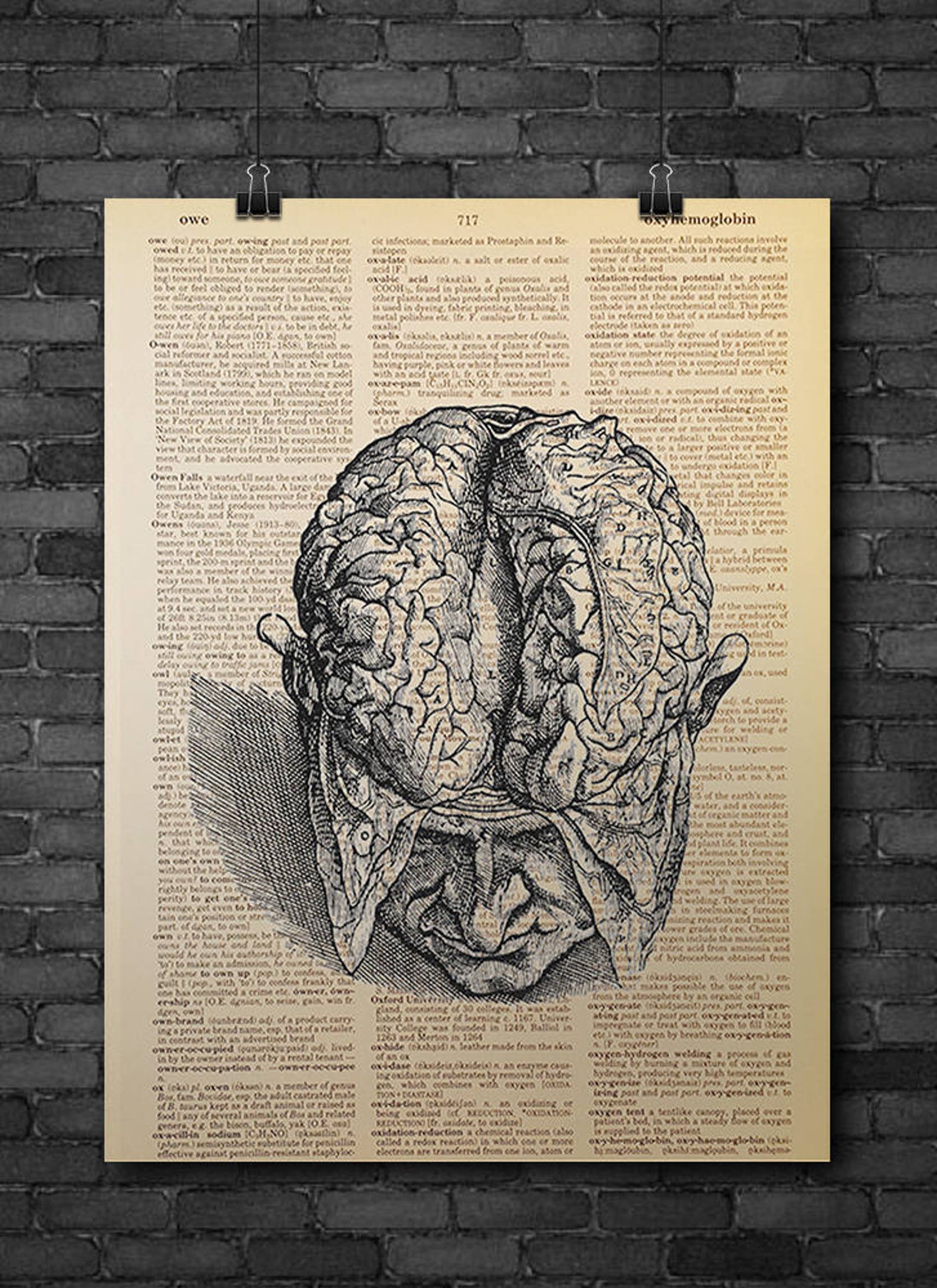 Brain Anatomy Vintage Illustration Medical Art Dictionary - Etsy