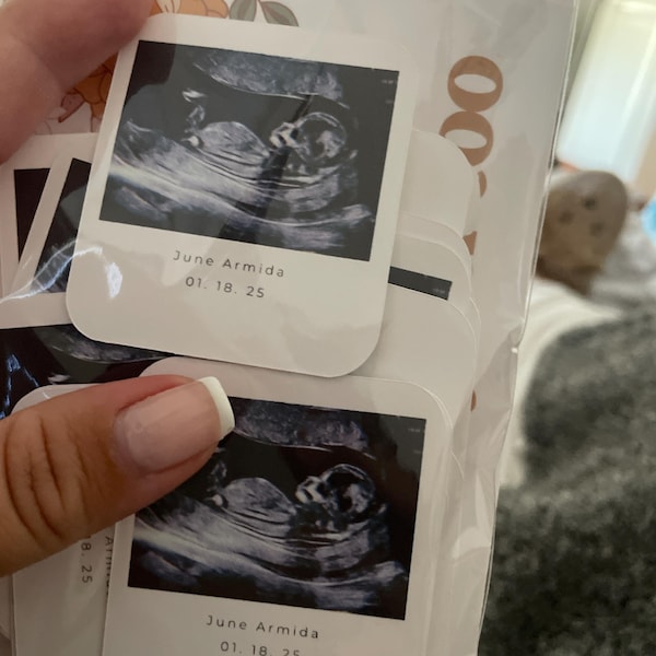 Baby Shower Decorations | Ultrasound Confetti | Custom Decorations Baby ...