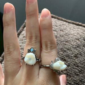 Trio Teeth Ring. Available With/ Without Braces Gem Cavities - Etsy