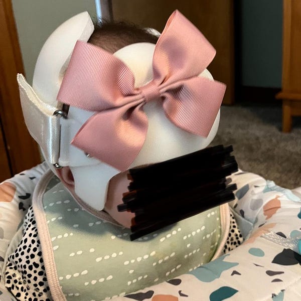 SETS OF 3 BOWS Cranial Helmet Bow Doc Band Bow Starband Bow - Etsy