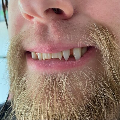 Werewolf / Wolf / Werewolf Teeth / Animal / Natural Wyndigu Teeth ...