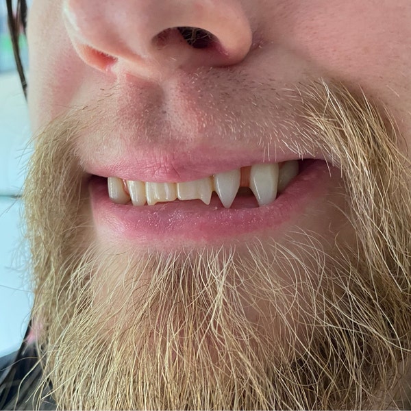 Werewolf / Wolf / Werewolf Teeth / Animal / Natural Wyndigu Teeth ...