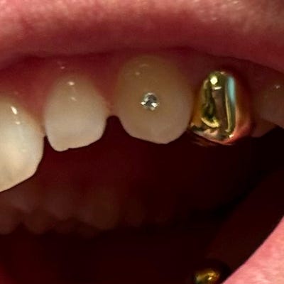Real Solid 10K Gold Double Side Canine Teeth Custom Grillz - Etsy