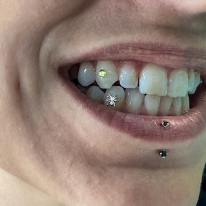 18k Gold LOGO Tooth Gems - Etsy