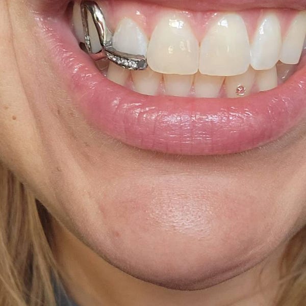 BLACK GRILLZ Hip Hop, Sadboi Style Custom Made Rapper Jewellery Grillz ...