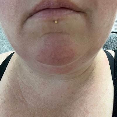 Bioflex Labret Nose Stud Retainer 2mm Disc Design. Clear, Flesh Colored ...