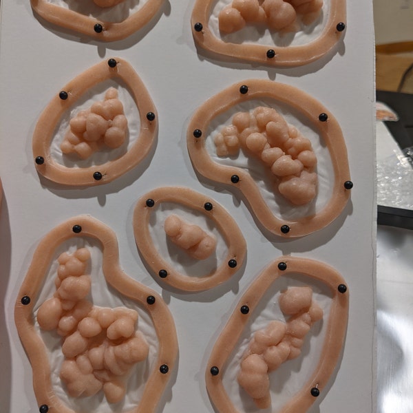 Cyst Growth Pack / Boils / Encapsulated Silicone Prosthetic / Abscess ...