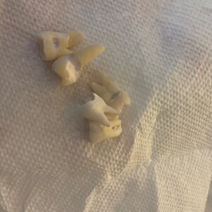 One Real Human Tooth Pendant Necklace - Etsy