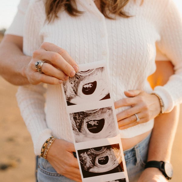 Traditional Ultrasound Strip - Upload Your Digital Images - Etsy