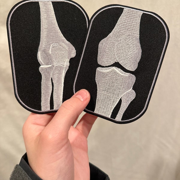 Elbow Patch | X-ray | Iron-on | Radiology | Broken Bone | Doctor | Ouch ...