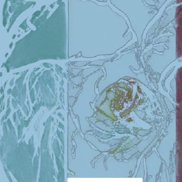 Radiology Doodles Png, Tee Rad Tech Png, Radiology Skeleton Png, Rad ...