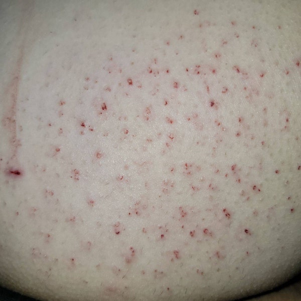 Victorian Finger Stocks, BDSM Vintage English School Punishment - Etsy