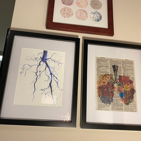 Aorta Angiogram Watercolor Art Print - Cardiovascular Painting - Blood ...