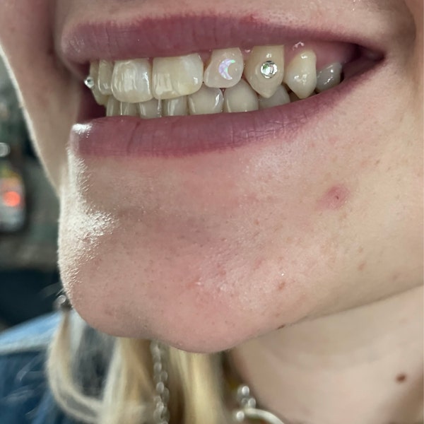 Tooth Gem Placement Tool - Etsy