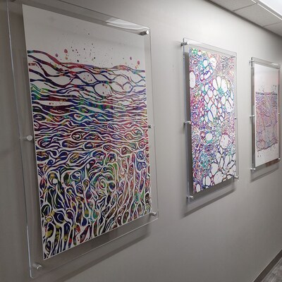 Cross Section of the Skin Watercolor Print Epidermis Histology ...