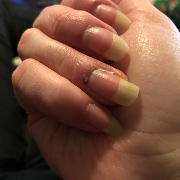 Cuticle Skin Covers - Etsy