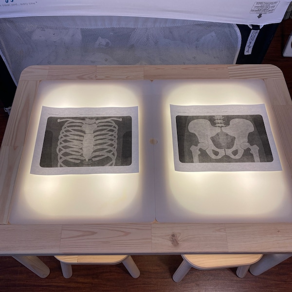 Printable X-ray Set for Kids Pretend Play (PDF Download A4/letter Size ...