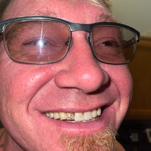 Solid 18k Gold & Rose Gold Tooth Charm Tooth Gem One Piece - Etsy