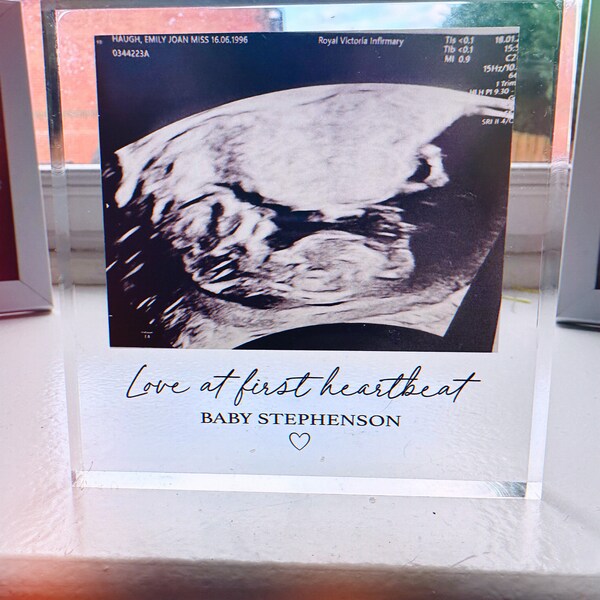 Baby Scan Photo | Baby Scan Frame | Baby Scan Gift | Ultrasound Print ...
