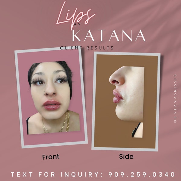 Laser Lipo Belt, Red Light Therapy, Infrared Light Deep Therapy Device ...