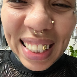 10K Gold Custom Grillz Two Front Teeth Real Solid Gold Double - Etsy