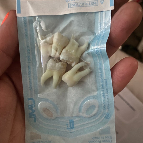 10 Real Human Teeth molars, Premolars, & Anteriors - Etsy