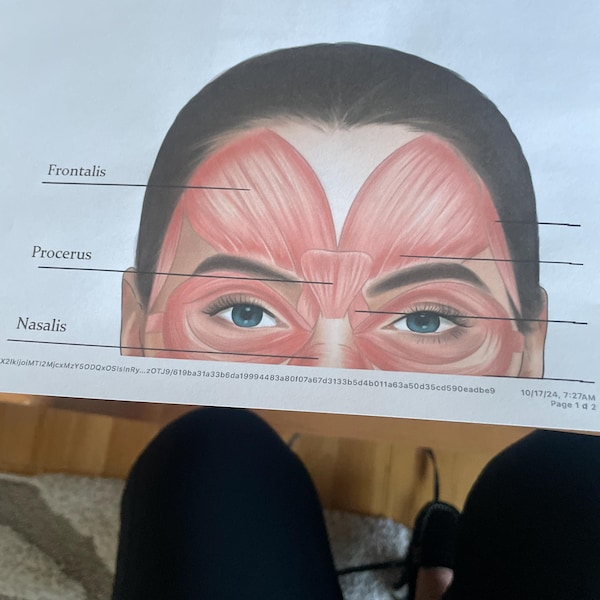 Botox Injection Points on Muscle Anatomy | Botox & Filler Injector ...