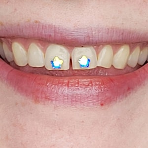 Gold 18K Tooth Gem - Etsy