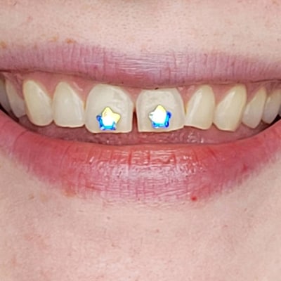 Gold 18K Tooth Gem - Etsy