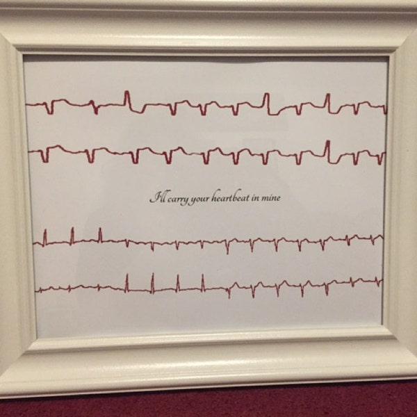 Memorial Gift Loss of Father | Last Heartbeat EKG Tracing Turned Into ...