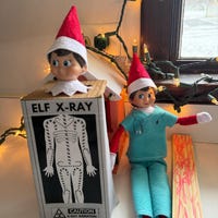 Printable Elf X-ray Props, Christmas Elf Doctor Scene, Xmas Elf ...