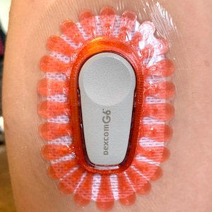 Flexible Dexcom G6 Cover Holds and Protects Sensor and Patch Over Patch ...