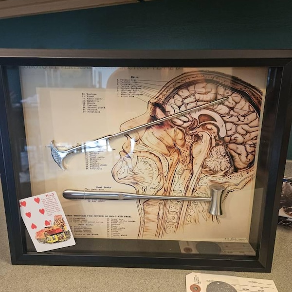 Vintage Embalming Eye Caps (opaque) - Etsy