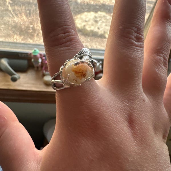 Trio Teeth Ring. Available With/ Without Braces! Gem Cavities Also ...