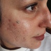 14K 16G Solid Gold Dermal Piercing/internally Threaded Dermal Anchor ...