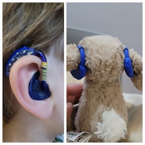 Toy Cochlear Implants From the Bear Ear Clinic by Toy Like Me - Etsy