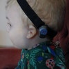 Cochlear Implant Skins for Baha 5/6, Osia 2, Kanso, Kanso 2, Stickers ...
