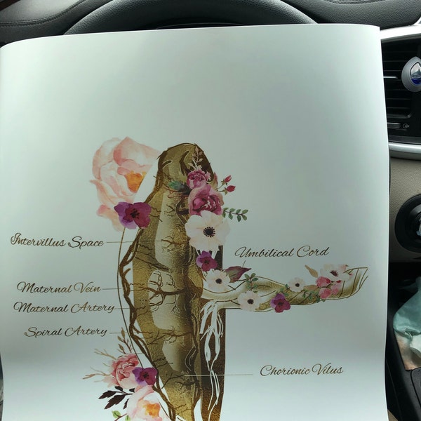 Placenta Anatomy Art, Fetal Placenta, Obstetrician Gift, Pregnant Gift ...