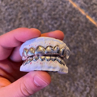 The BEST Mold Kits for Grillz Mold Impression Kit for Custom - Etsy