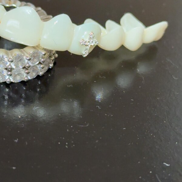Tooth Caviar Glass Crystals - Etsy