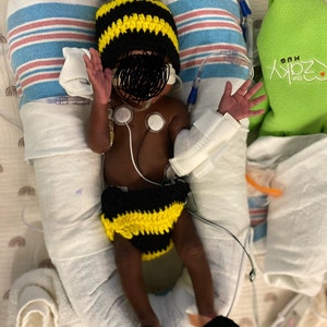 NICU Little Frog Micro Preemie Outfit With Overalls, Fits 2, 3, or 4 ...