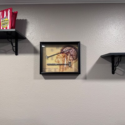 BESTSELLER Lobotomy Shadowbox Display Large - Etsy