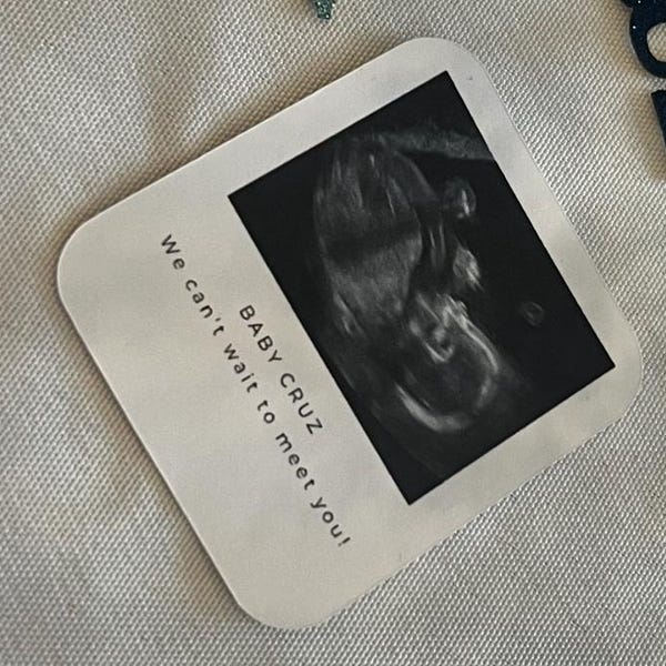 Baby Shower Decorations | Ultrasound Confetti | Custom Decorations Baby ...